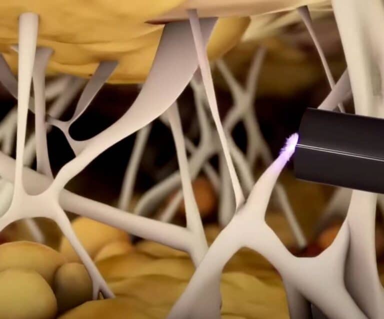 J Plasma Miami _ Summer Plastic Surgery